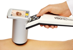 D200evo | Canfield Scientific